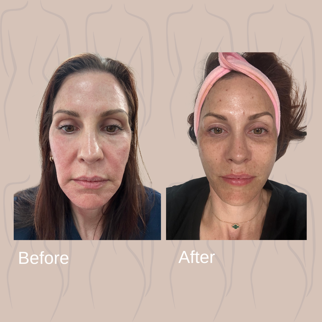 Before & After Archive | Frisco Body Contouring and Weight Loss